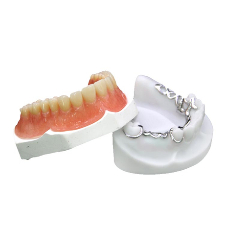 Framework/Cast Partial - China Dental Laboratory (CDL) Co., Ltd